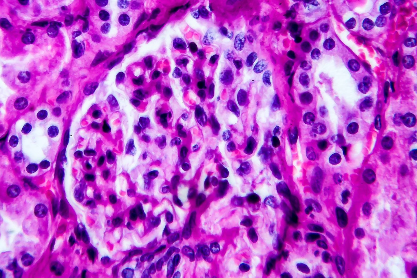 Australian Biostain - a CSA Pathology brand