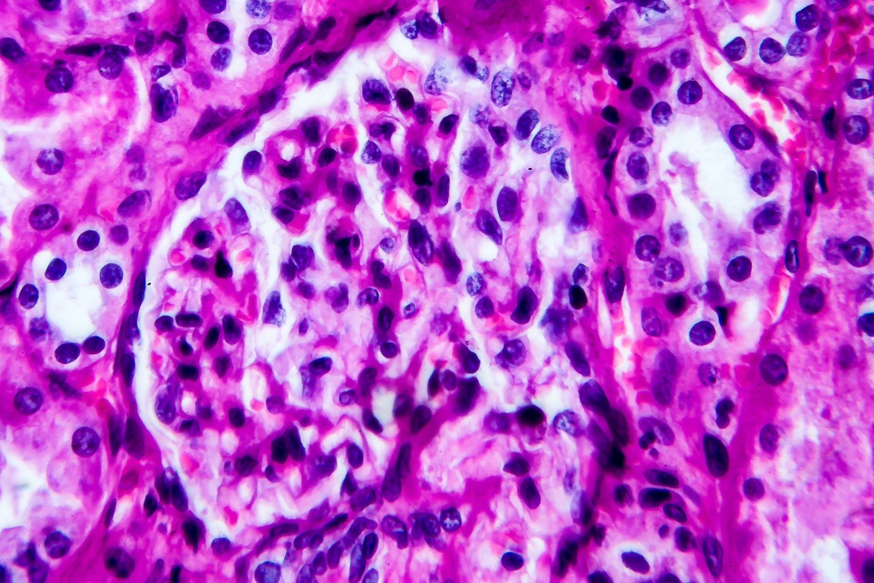 Australian Biostain - a CSA Pathology brand